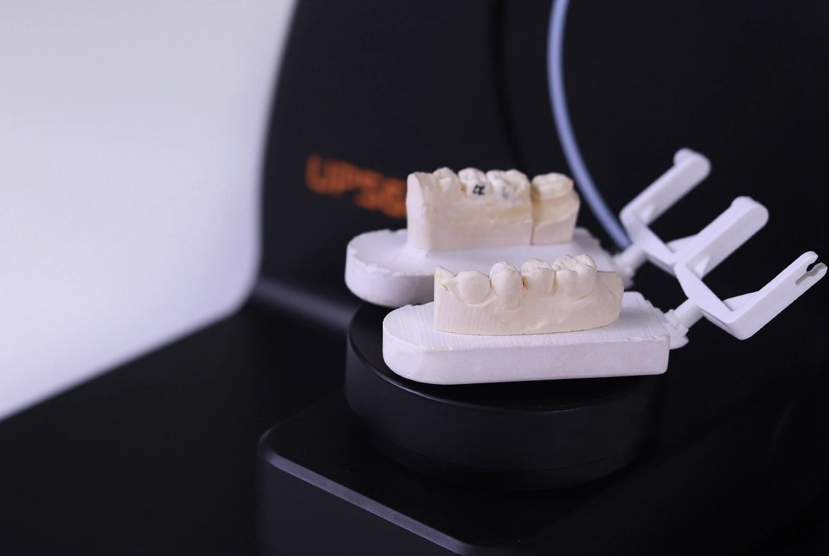UP560HD Dental Lab Scanner – 4μm, Dual 5MP, 10s Scan | UP3D