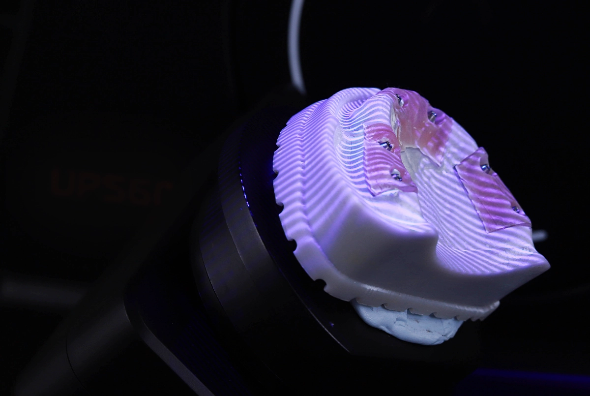 UP560HD Dental Lab Scanner – 4μm, Dual 5MP, 10s Scan | UP3D