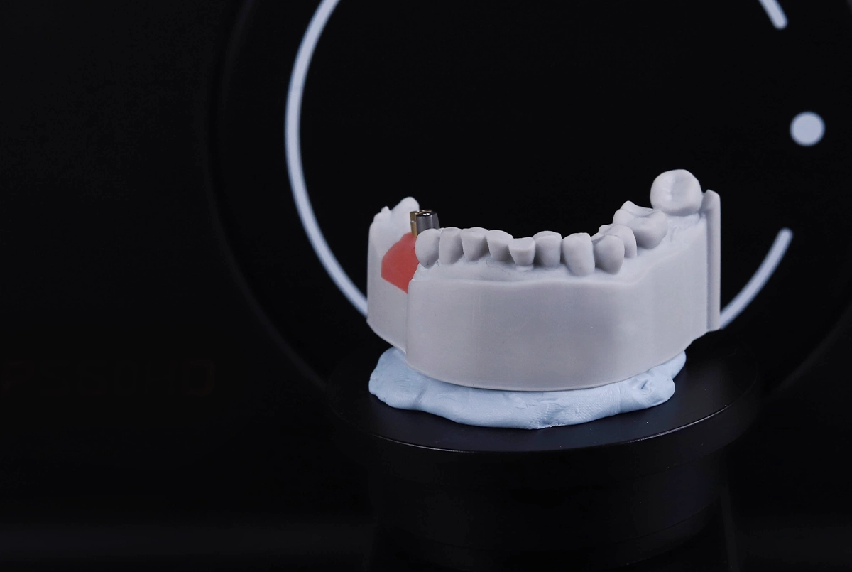 UP560HD Dental Lab Scanner – 4μm, Dual 5MP, 10s Scan | UP3D