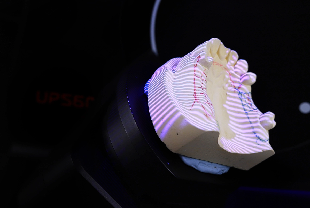 UP560HD Dental Lab Scanner – 4μm, Dual 5MP, 10s Scan | UP3D