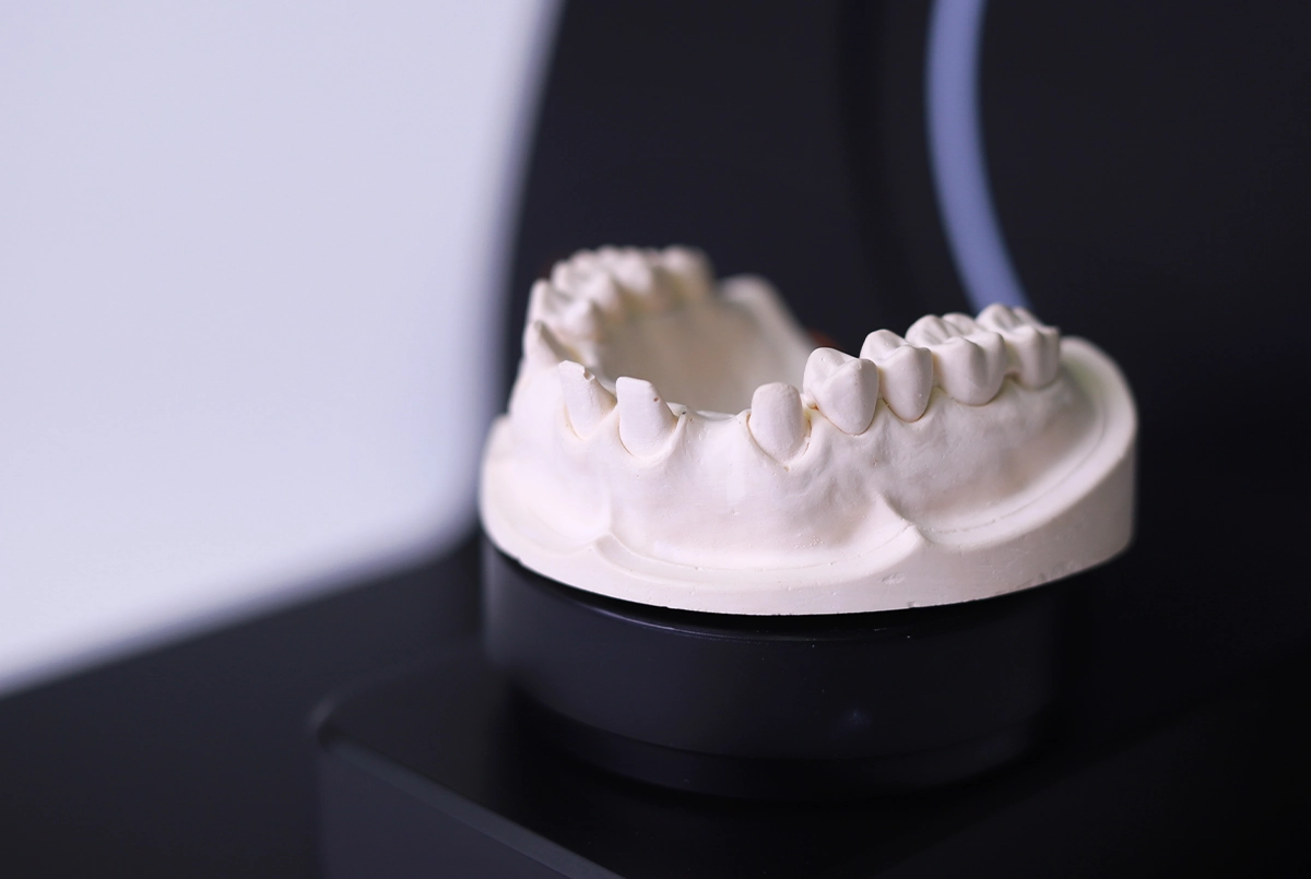 UP560HD Dental Lab Scanner – 4μm, Dual 5MP, 10s Scan | UP3D