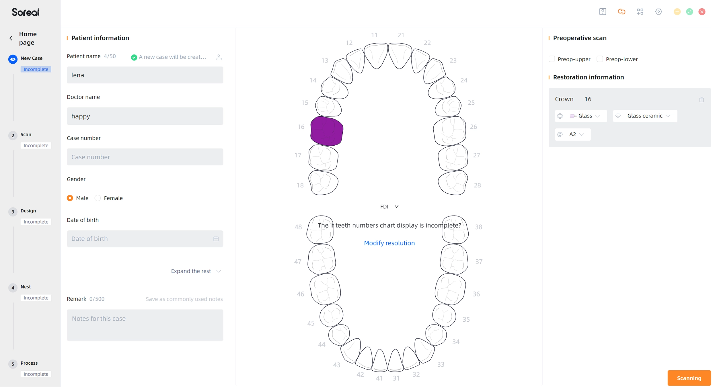 Soreal Chairside CAD/CAM Solution | Same-Day Dental Restorations