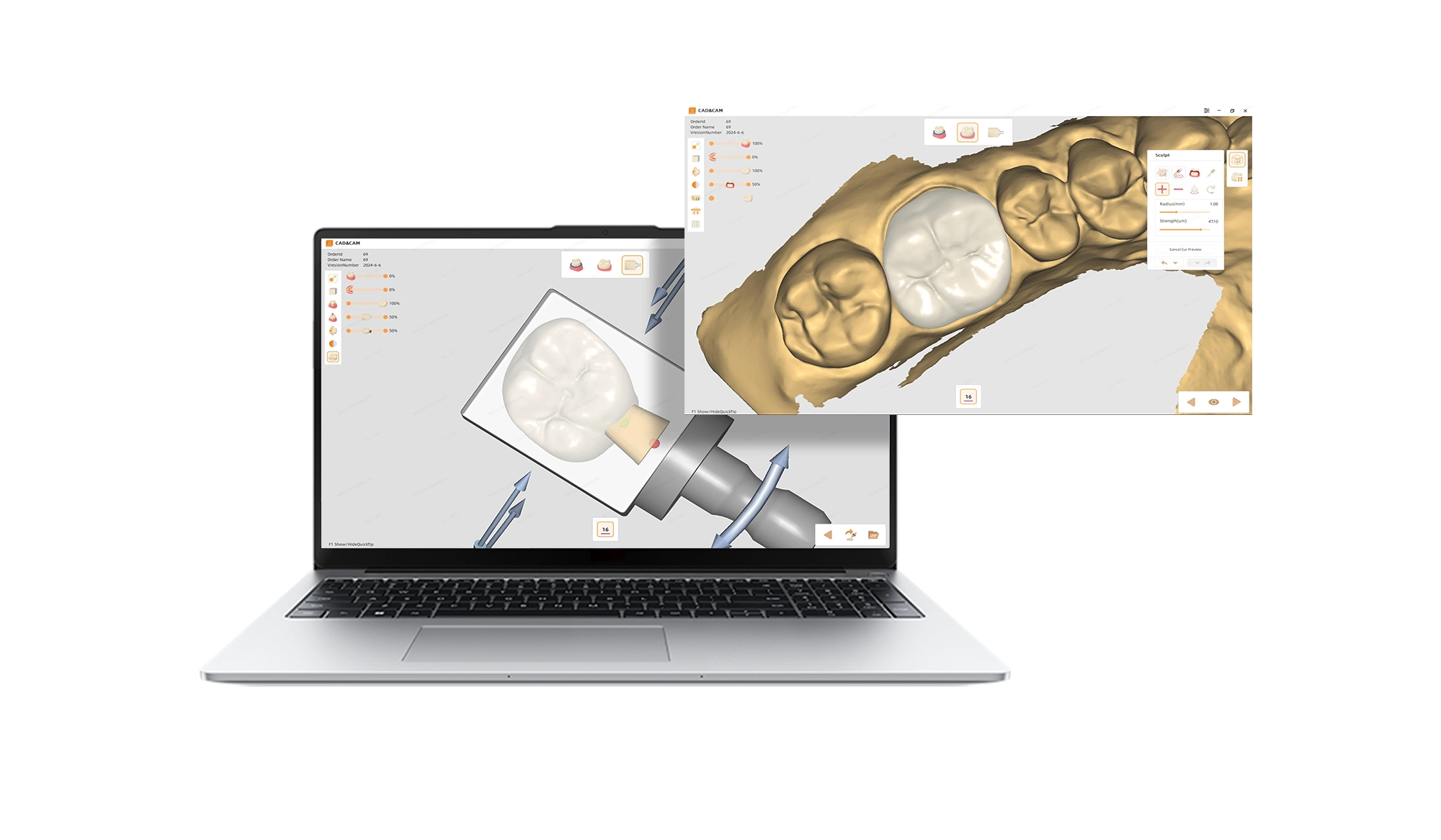 Soreal Chairside CAD/CAM Solution | Same-Day Dental Restorations