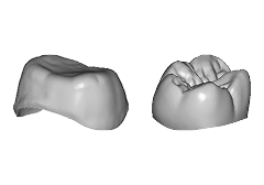 UP3D Lab Solution | Complete Dental CAD/CAM Workflow for Every Lab