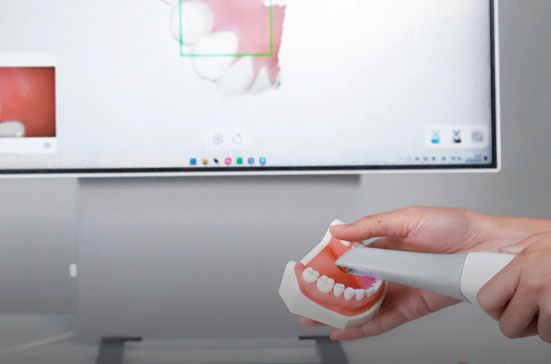 UP610 Intraoral Scanner | High-Precision, Lightweight & Fast Scanning ...