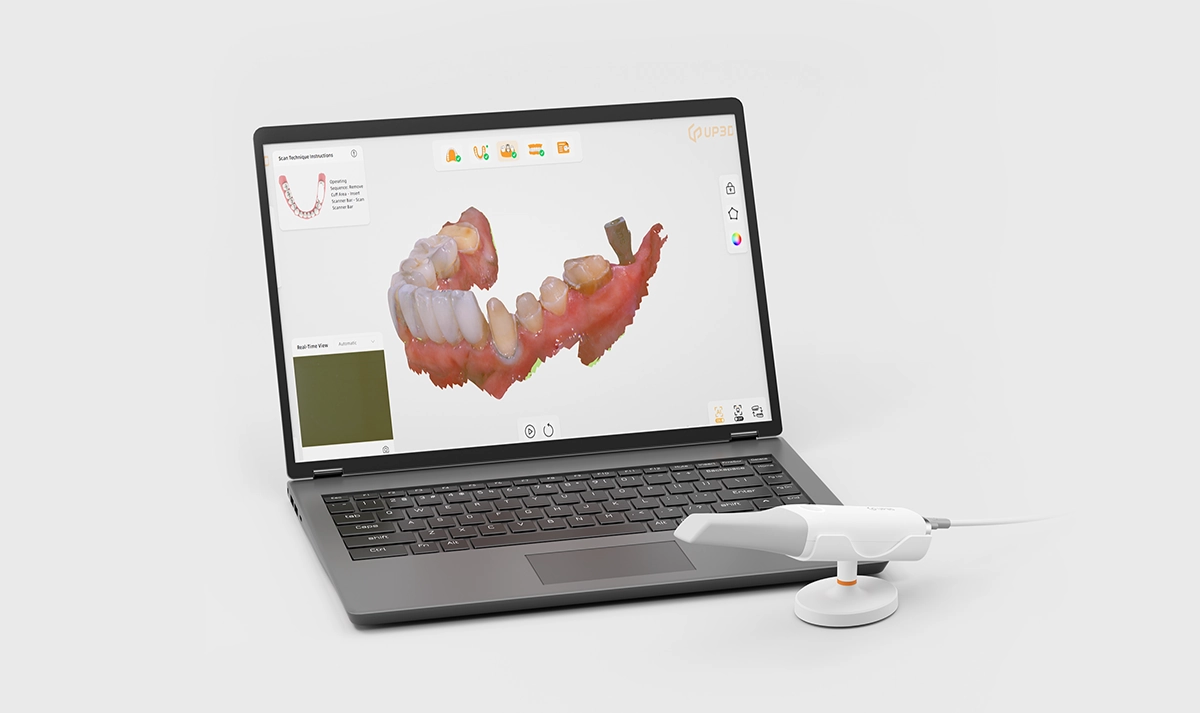 UP610 Intraoral Scanner | High-Precision, Lightweight & Fast Scanning ...
