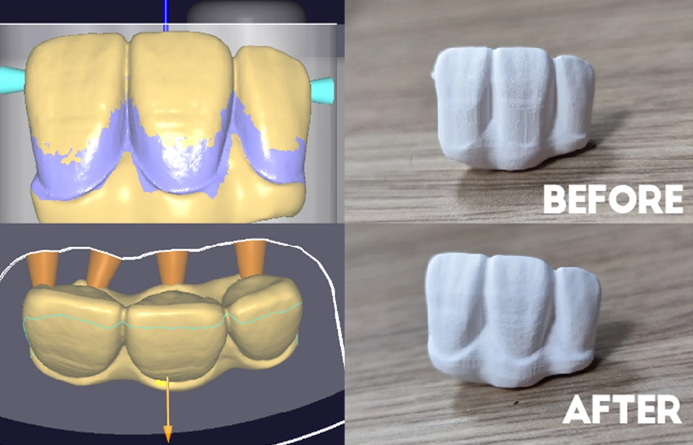 UPCAM | Smart Dental CAM Nesting Software by UP3D