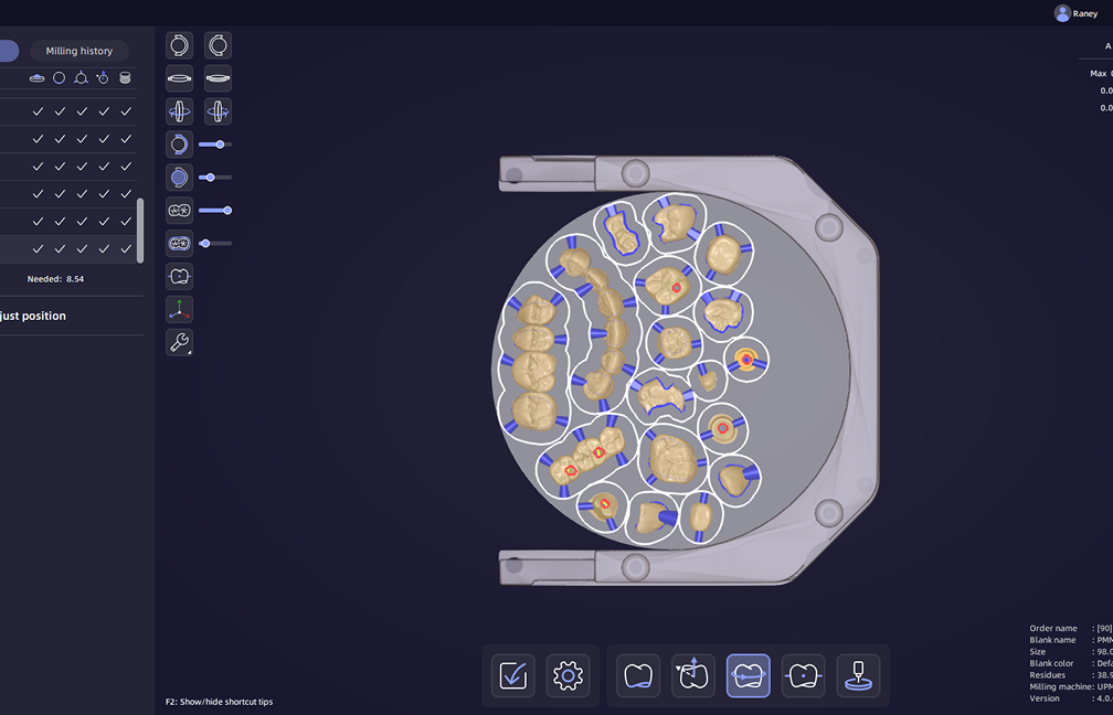 UPCAM | Smart Dental CAM Nesting Software by UP3D