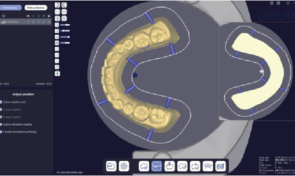 UPCAM | Smart Dental CAM Nesting Software by UP3D
