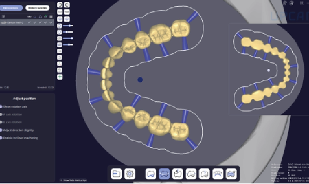 UPCAM | Smart Dental CAM Nesting Software by UP3D