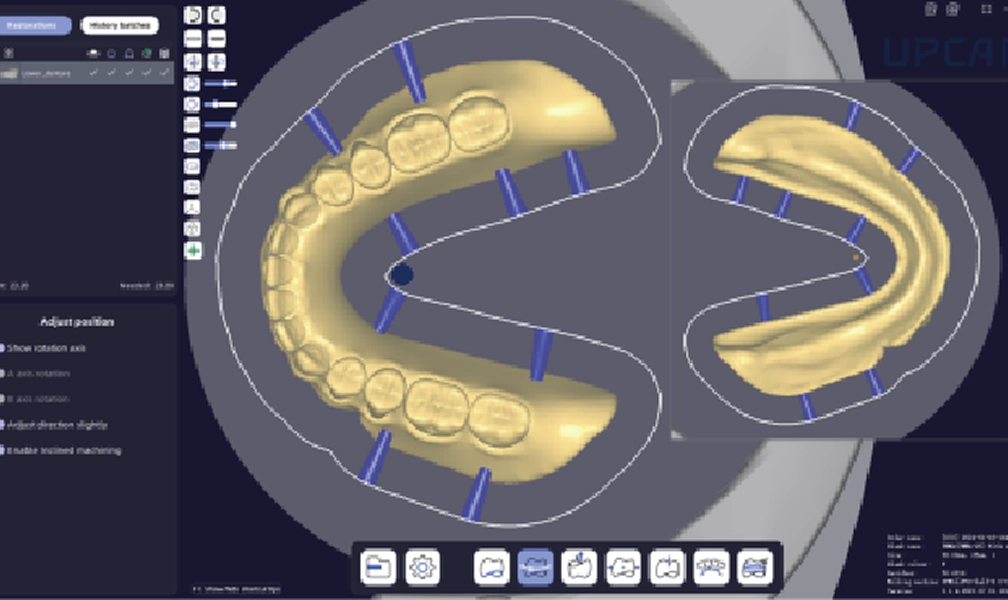 UPCAM | Smart Dental CAM Nesting Software by UP3D