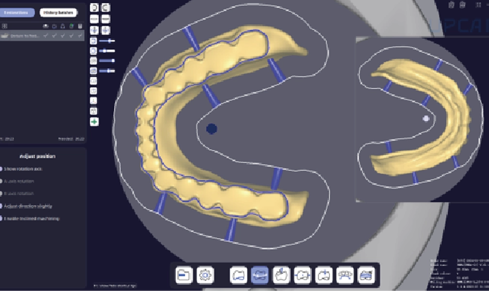 UPCAM | Smart Dental CAM Nesting Software by UP3D