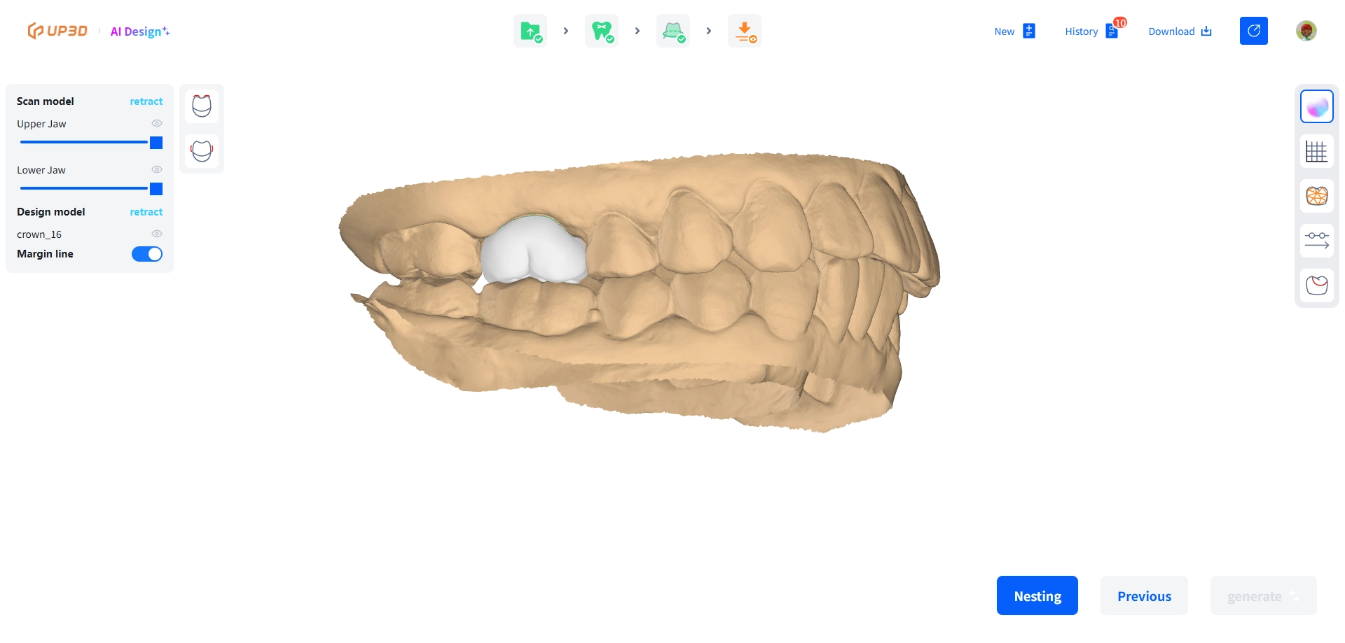 UP3D AI CAD | Web-Based AI Dental Design – 30-sec Crowns