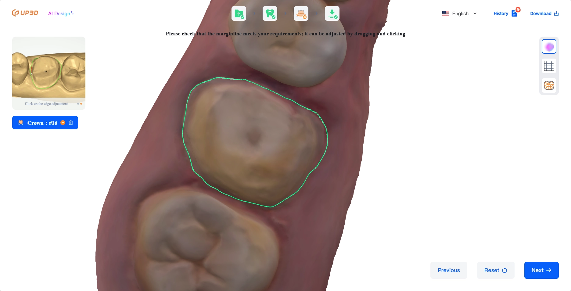 UP3D AI CAD | Web-Based AI Dental Design – 30-sec Crowns