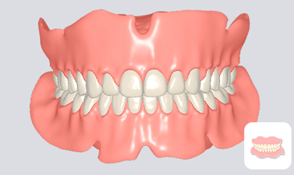 UPCAD – Smarter, Intuitive Dental CAD | UP3D