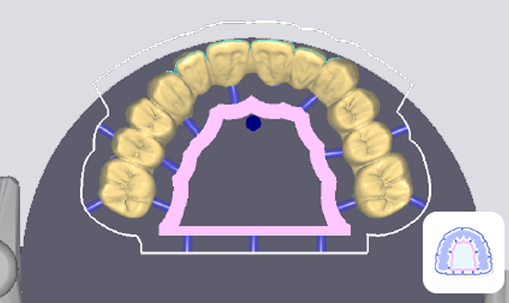 UPCAD – Smarter, Intuitive Dental CAD | UP3D